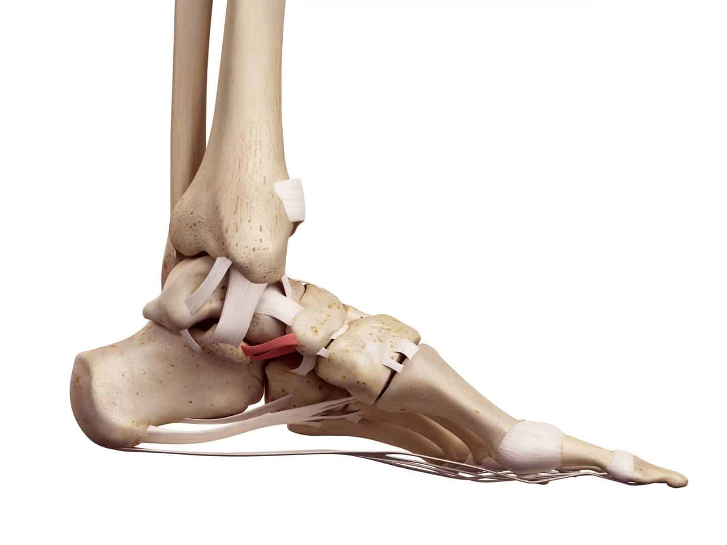 Dolor en el talón - Podólogo cerca de Pittsburgh- Beaver Valley Foot Clinic