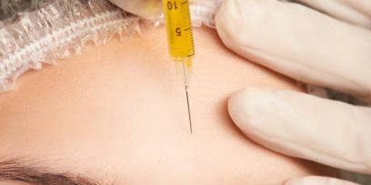 Botox for Hyperhydrosis - Beaver Valley Foot Clinic